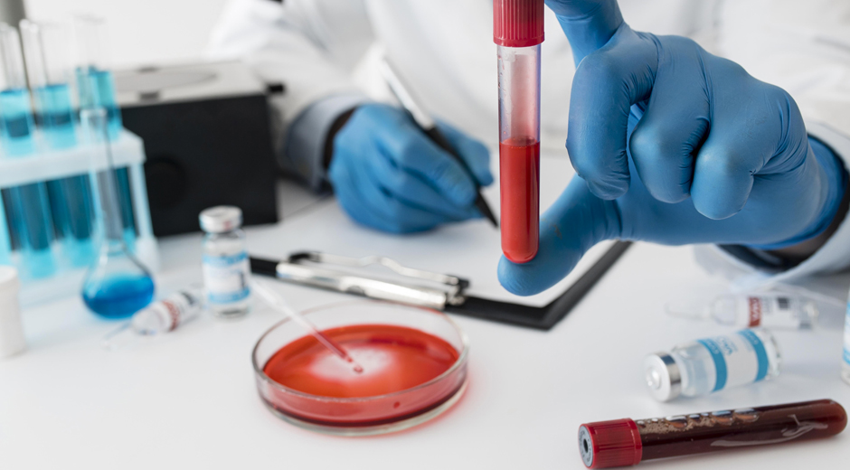 Laboratory Tests Blood Tests At Home HMS Mirdif Hospital Laboratory Tests Blood Tests At Home HMS Mirdif Hospital